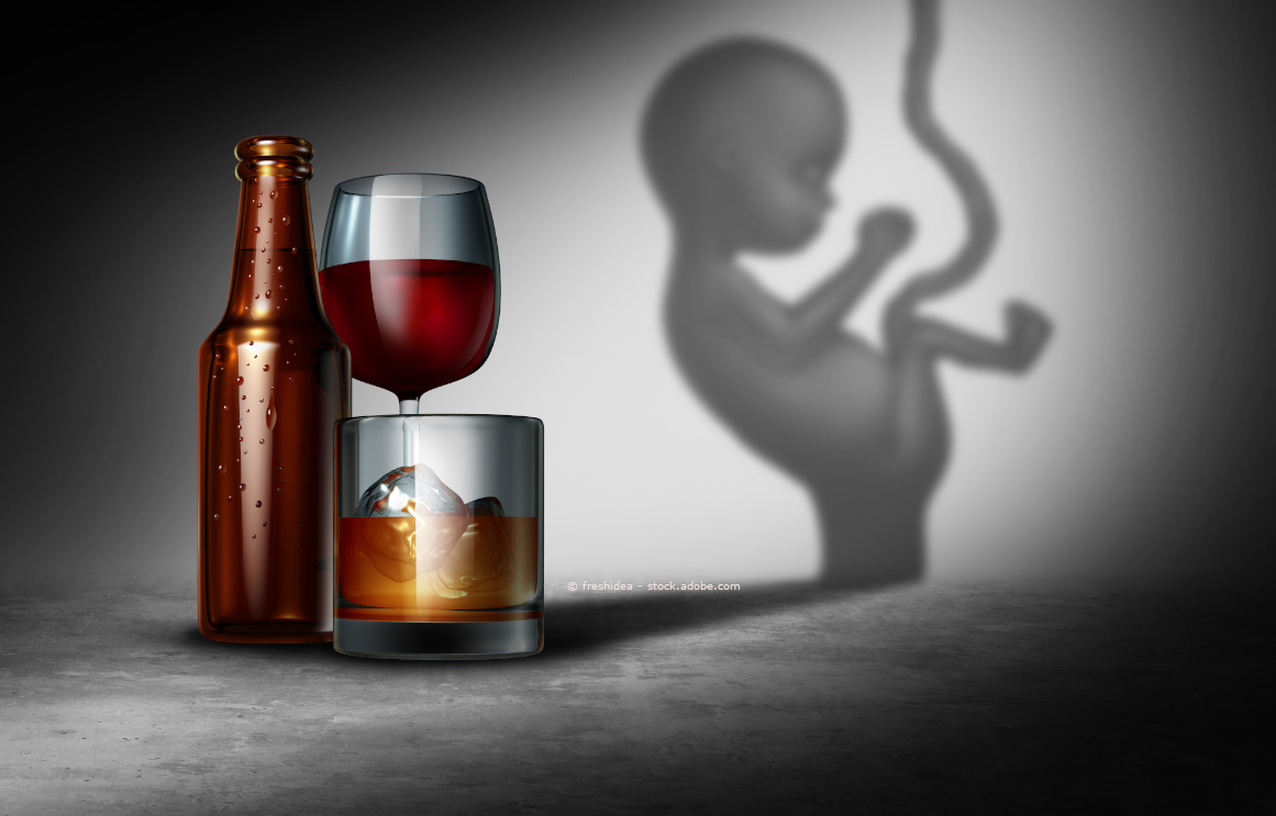 FAS - Alkohol in der Schwangerschaft schadet Ihrem Kind