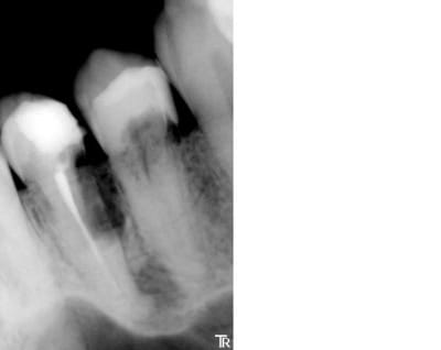 Rjp s1ex3i - Eugenol