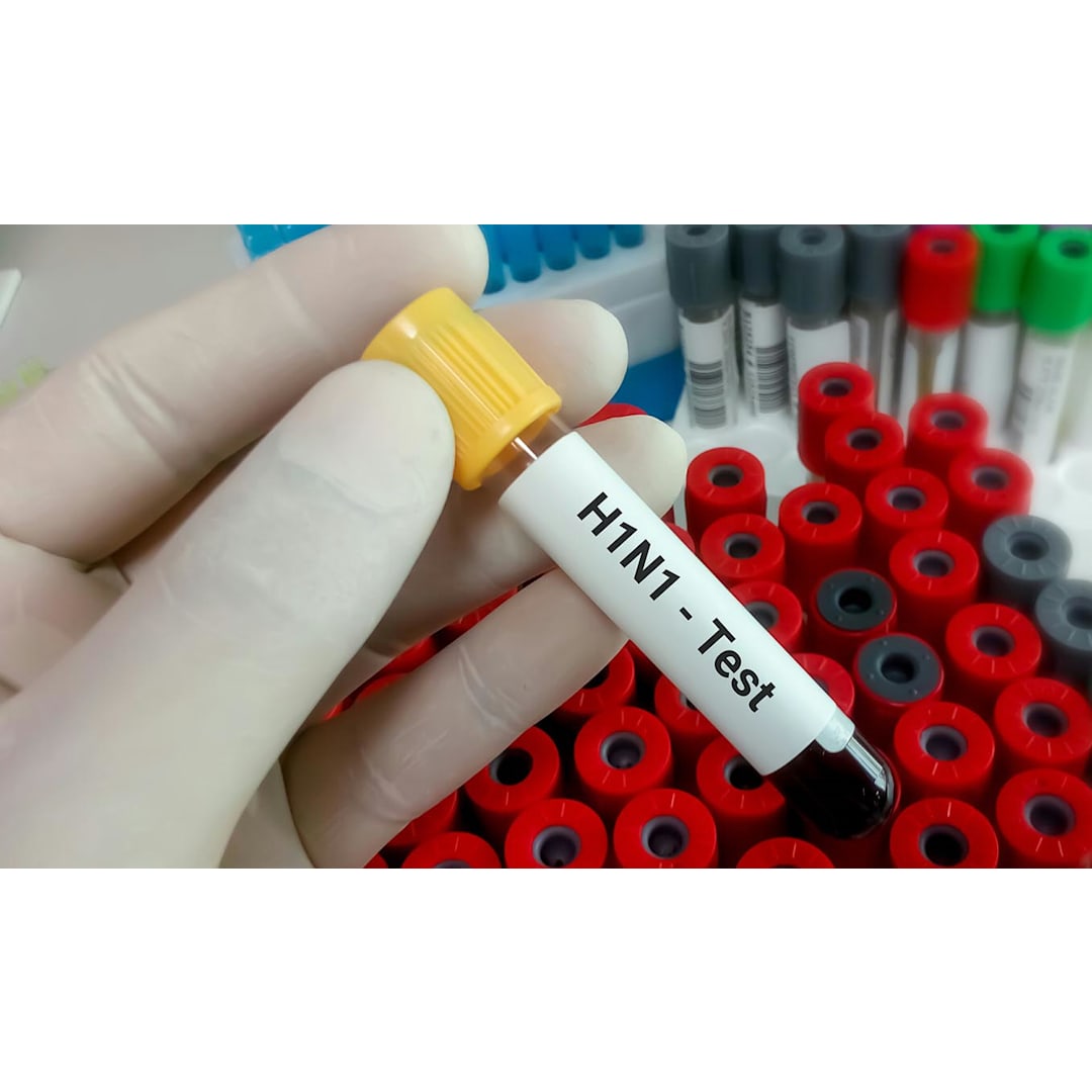 h1n1 test