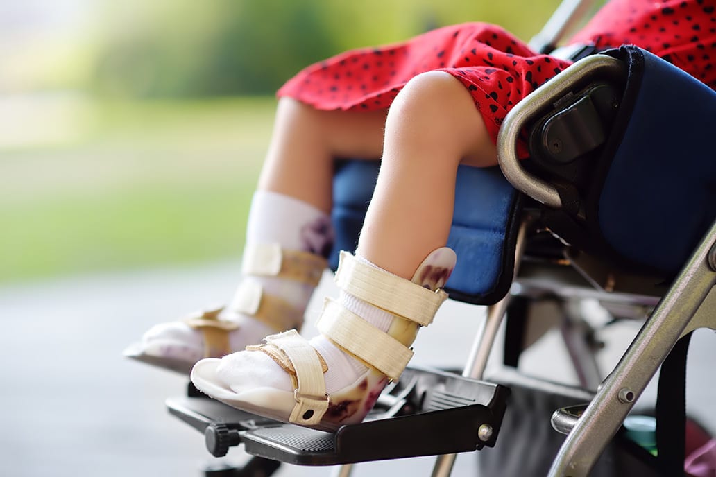 Birth injury claim involves lack of advice to mother