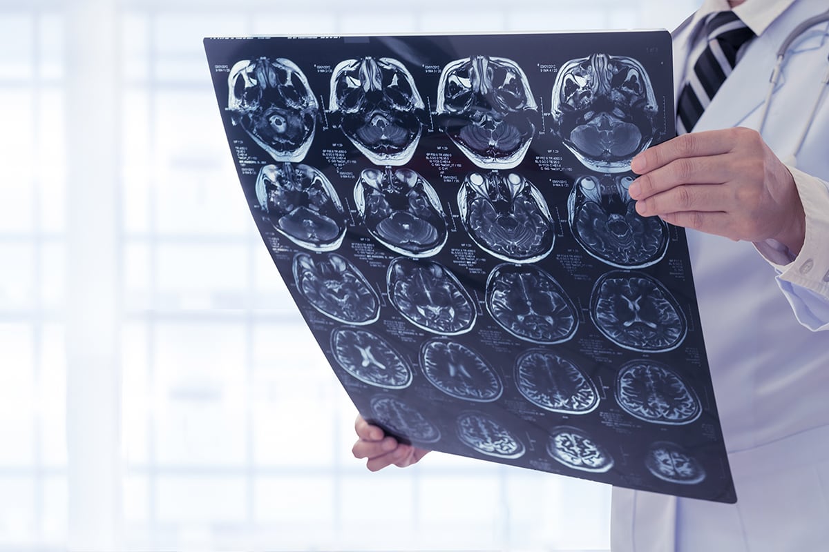 £1.7m settlement for young man left brain-injured by failures at UCLH