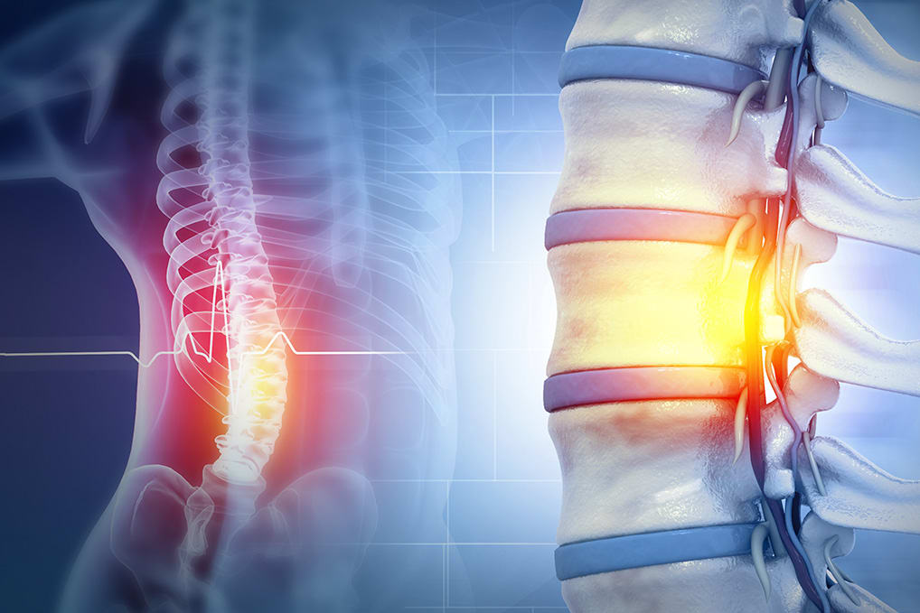 Medical 'decoder' could help those with spinal cord injury move again ...